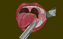 Awake Fiberoptic Intubation Made Rapid and Reliable | Marjorie Stiegler MD